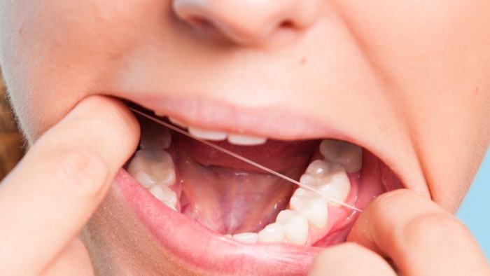 Dental Emergency - Pain - Something Stuck Between Teeth